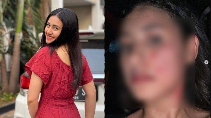 Selebgram Afifah Riyad Babak Belur Dianiaya Eks Pacar Suami, Bayinya Disumpahi Celaka Sama ...