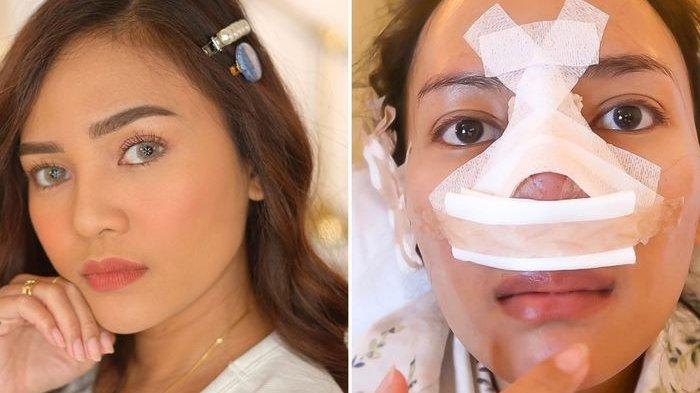 Alami Ini Dalam Waktu Lama, Beauty Vlogger Rachel Goddard Harus Jalani ...