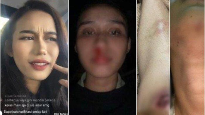 Polres Tangerang Selatan Buka Suara soal Kasus Mahasiswi UPH Disiksa Pacar hingga Hidung Bengkok ...