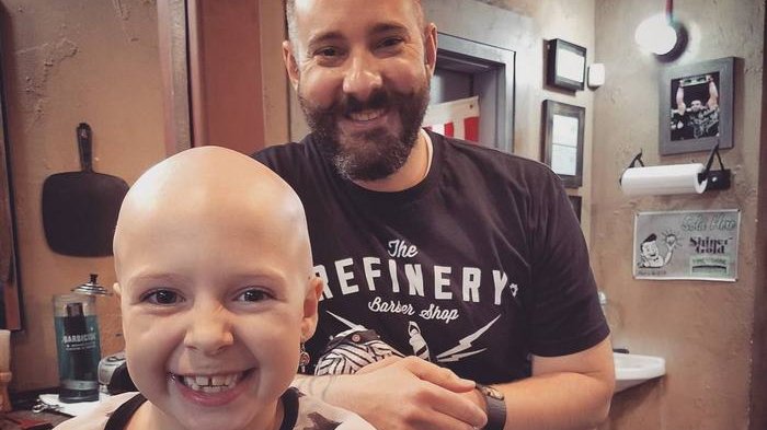 GALERI FOTO: Jadi Botak Karena Penyakit, Gadis Malang ini Pukau Teman ...