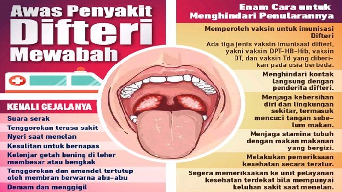 Sejarah Penyakit "Kuno" Difteri, Hingga Bisa Muncul Banyak di Zaman Ini ...