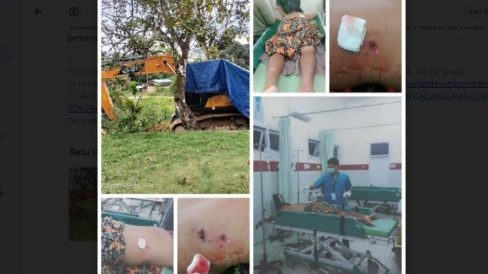 Operator Eskavator di Merangin Ditembak OTK, 2 Peluru Bersarang di ...