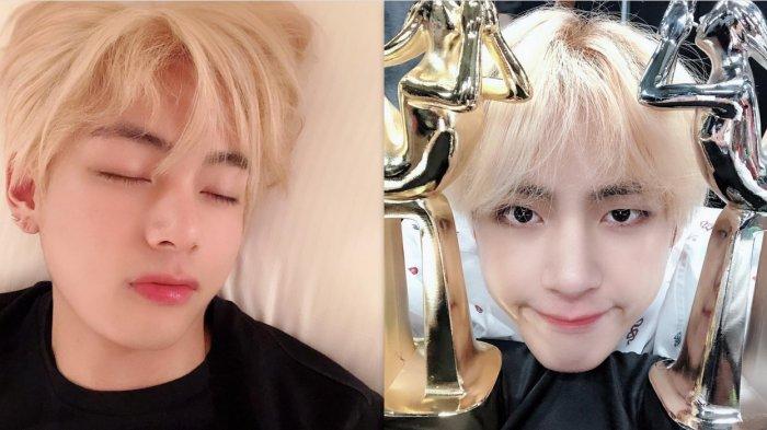 Derita Penyakit Kulit, V BTS Akui Alami Cholinergic Urticaria, Gejala ...