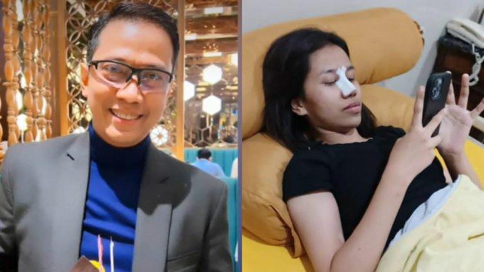 Doddy Sudrajat Kembali jadi Sorotan, Operasi Plastik pada Bagian ini ...