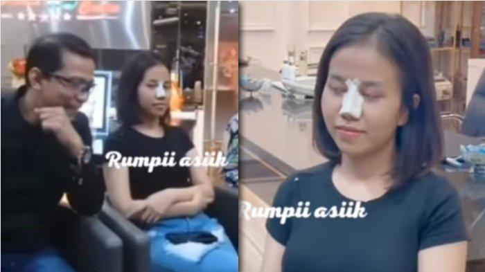 Operasi Hidung, Wajah Mayang Adik Vanessa Angel Malah Bikin Netizen ...