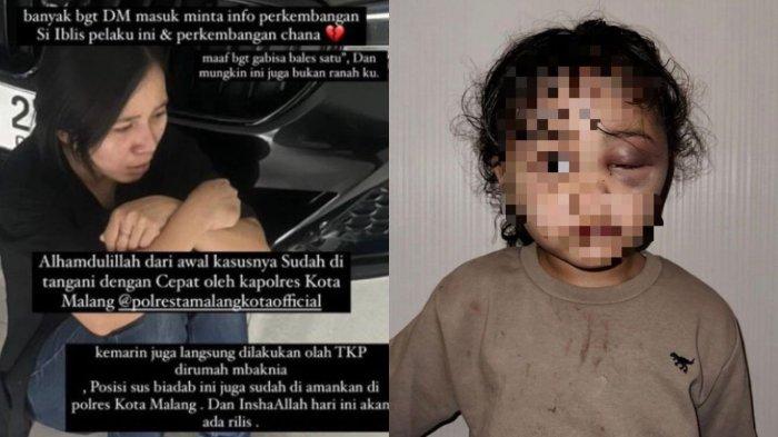 Reaksi Pengasuh Anak Aghnia Punjabi saat Ditangkap Polisi Bikin Warganet Geram: Kayak Psikopat ...