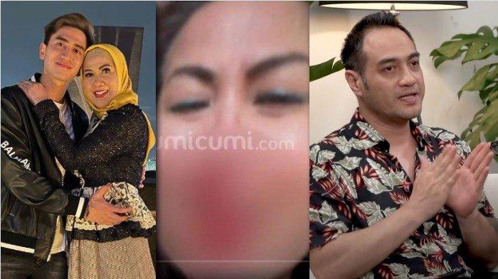 Venna Melinda Sempat Minta Tolong ke Verrell Bramasta, Ibunda Athalla Keburu 'Dihajar' Ferry ...
