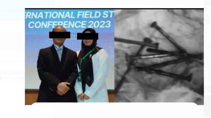 Viral Istri Dosen di Yogyakarta Diduga Kena Santet, Telapak Tangan dan Kakinya Keluar Paku dan ...