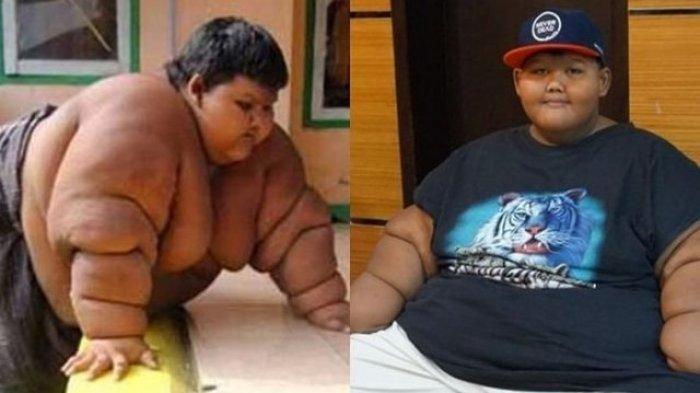 Ingat Arya Permana? Dulu Dijuluki Bocah Terberat di Dunia, Kini Berubah ...