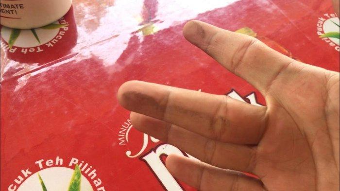 Penampakan Dampak Stopel Batubara, Kesehatan Warga Desa Muara Jambi ...