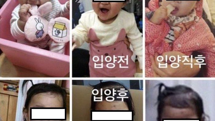 Siapa Sebenarnya Jeongin Bayi 16 Bulan di Korea Meninggal Dianiaya ...