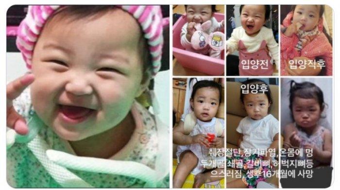 Jeongin Bayi 16 Bulan Korban Kekerasan, Kisahnya Sangat Menyedihkan ...
