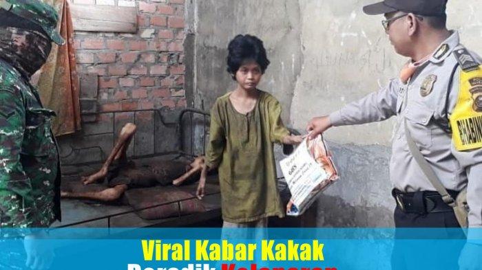 Unggahan Video Hotman Paris Soal Kakak Adik yang Kurus Kering, Fakta Terbaru, Bupati Baru ...