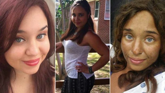 Kondisi Mengerikan! Perbedaan Kondisi Lisa Sebelum dan Sesudah Hilang ...