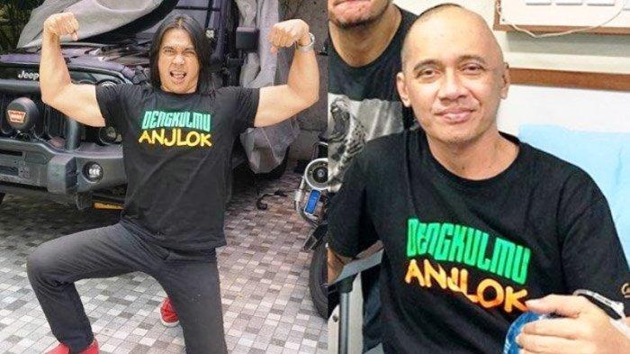 Apa Itu Sebenarnya Kanker Glioblastoma? Penyakit yang Buat Agung ...