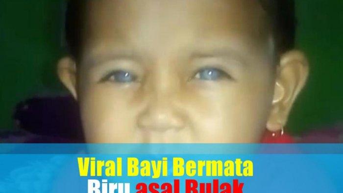VIDEO: Viral Bayi Bermata Biru di Kampung Bulak Sentul, Bekasi ...