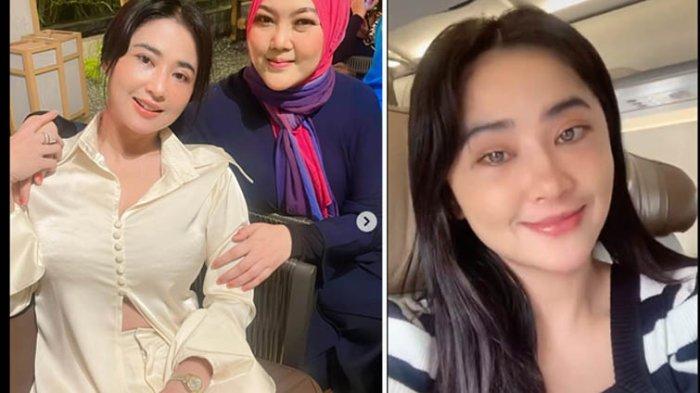 Dewi Perssik Bantah Operasi Plastik karena Wajah Terlihat Beda: Aku Gak Suka Permakan ...