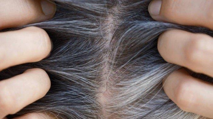 dr. Zaidul Akbar Bagikan Tips Mengatasi Uban Rambut, Ternyata Sangat ...