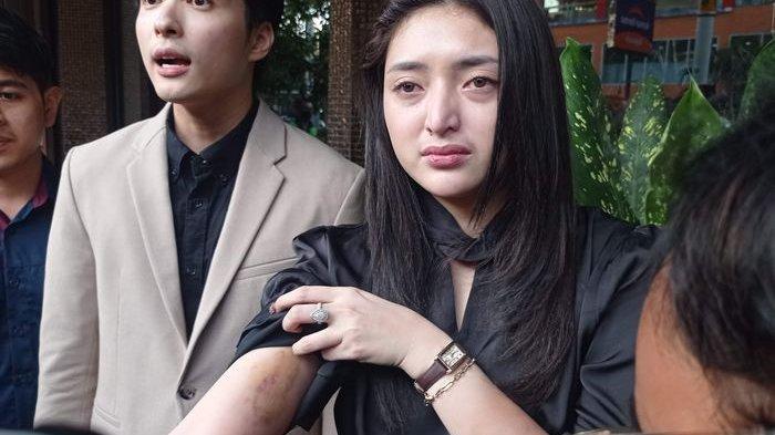 5 Berita Populer: Aspri Hotman Paris Jadi Korban Penganiayaan hingga Kepsek Tewas Saat Bersama ...