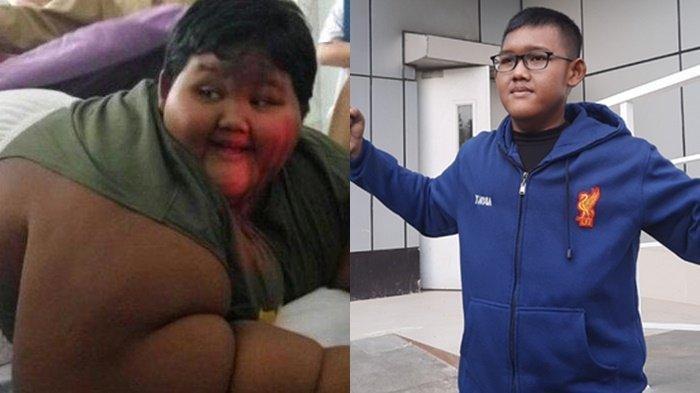 Ingat Arya Permana? Pernah Obesitas dan Viral Seperti Muhammad Fajri ...
