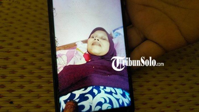 Sulami Manusia Kayu dari Sragen Meninggal, Selfie Terakhir Jadi ...