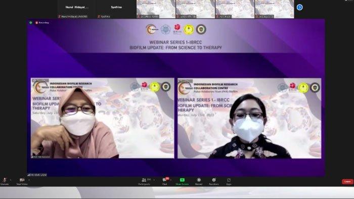 UNSOED Berkolaborasi Dalam Riset Biofilm - Tribunjateng.com