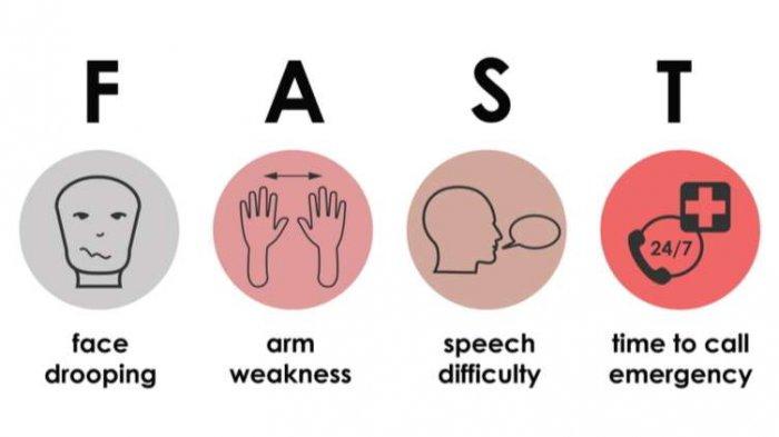 Kecepatan dalam Kesehatan = 'Time Is Brain' F.A.S.T - Tribunjateng.com