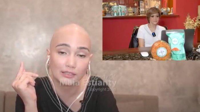 Artis Feby Febiola Kini Botak Plontos Berjuang Melawan Kanker Ovarium ...