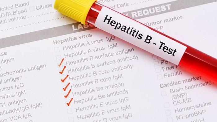 Apa Itu HBsAg Positif? Ini Gejala Lainnya untuk Diagnosis Penyakit ...