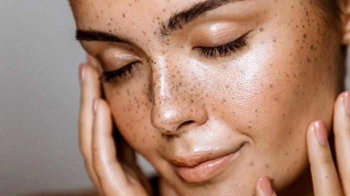 Perhatikan Hal Ini Agar Kulit Wajah Glowing Terbebas Dari Noda Hitam ...