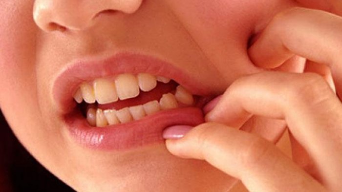 Hukum Cabut Gigi Saat Puasa, Bikin Batal Tidak? Berikut Penjelasannya ...