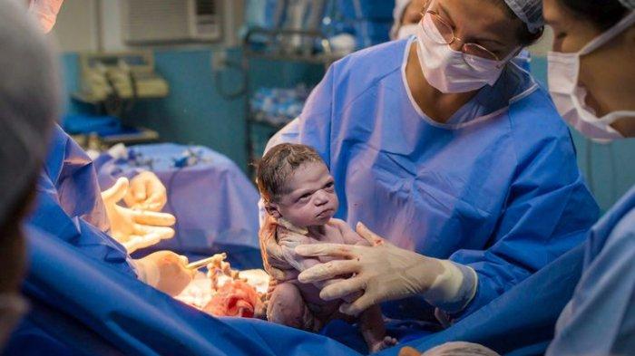 Ketika Dilahirkan, Bayi Ini Langsung Cemberut, Orangtua: Ini Bisa Jadi ...