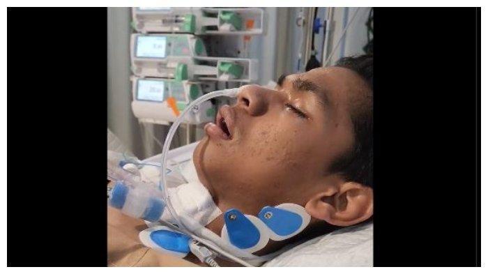 Foto-foto Kondisi Terkini David Korban Penganiayaan Mario Dandy Masih ...