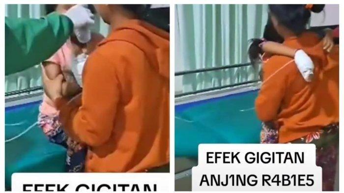 Kronologi Bocah 5 Tahun Meninggal karena Digigit Anjing Rabies, Viral ...
