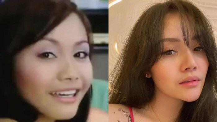 "Iyalah Rp 200 Juta!" Mawar AFI Blak-blakan Ungkap Harga Operasi Hidung ...