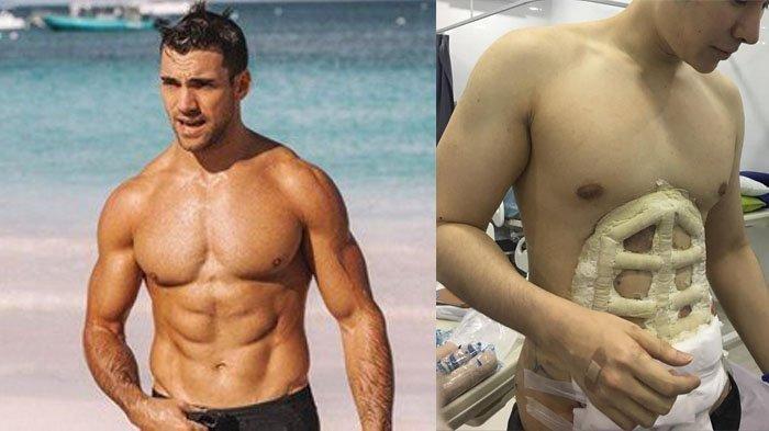 Tengah Laris Manis, Operasi Sixpack yang Bisa Buat Perut Berotot Secara ...