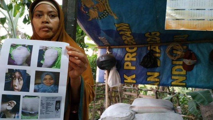 Tragis! TKW Indonesia Ini, Dijual Rp 110 Juta hingga Disiksa dan Disiram Air Panas di Arab Saudi ...