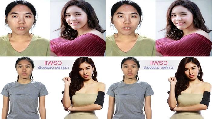 Reality Show 'Let Me In Thailand', Ubah Wanita Tonggos jadi Super Cantik - Tribunjateng.com