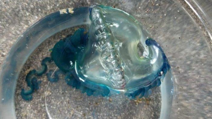 Waspada Serangan Sengatan Ubur-ubur Api di Pantai Selatan! Wisatawan ...