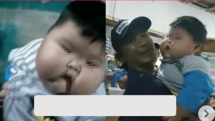 Viral Bayi 1 Tahun Berat Badan BB 25 Kg, Tiga Kali Lipat BB Normal ...