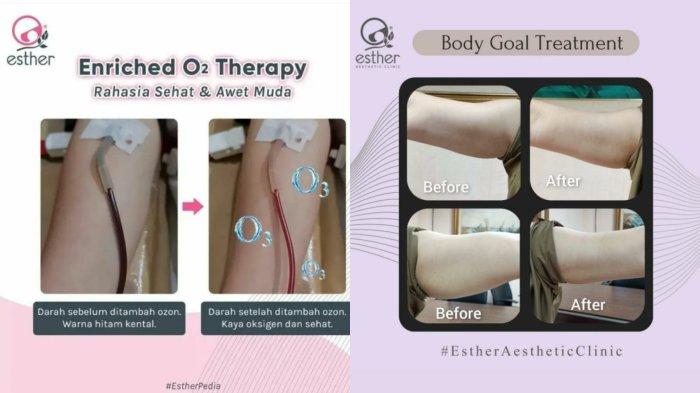 Peran Esther Aesthetic Clinic dalam 29 tahun Transformasi Kecantikan di ...