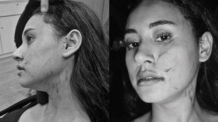 Sosok Afifah Riyad Selebgram yang Babak Belur Dianiaya Mantan Pacar ...