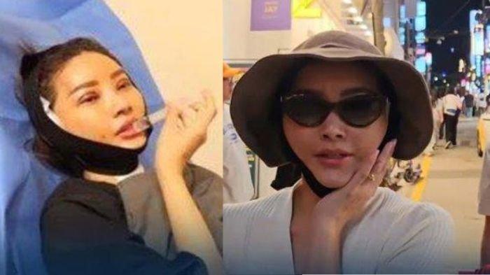 Alasan Sarwendah Operasi Wajah di Tengah Huru-Hara Dicerai Ruben Onsu, Boyong Anak ke Luar ...