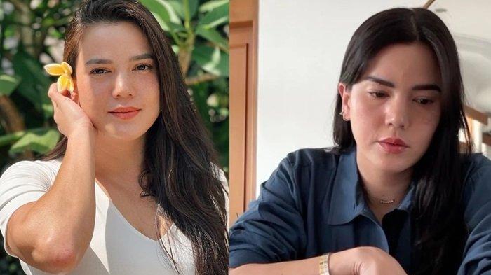 Alice Norin Derita Kanker Sarkoma di Otot Rahim, Sempat Tahan Sakit ...