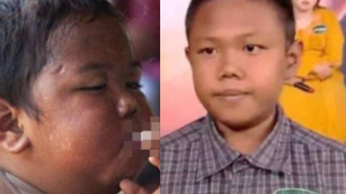 Cara Ardi Rizal Balita Perokok Atasi Kecanduan, Dulu Habiskan 40 Batang ...