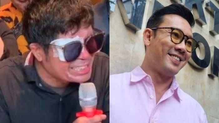 Denny Sumargo Ciut Ditantang Alvin Lim, Padahal Dijanjikan Rp3 Miliar ...