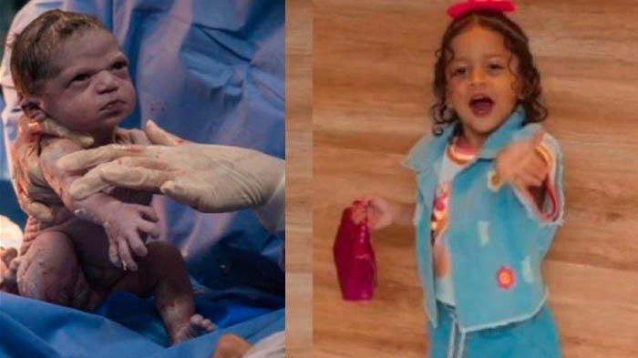 Sempat Viral Bayi Pasang Wajah Merengut Saat Baru Lahir, Kini Tumbuh ...