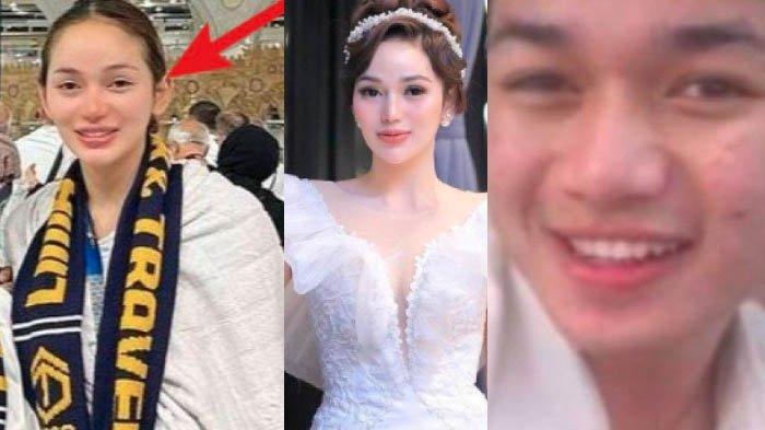 Dulu Suntik Hormon dan Pasang Implan, Transgender Jeje Ingin Taubat setelah Umrah, 'Jadi Bagas ...