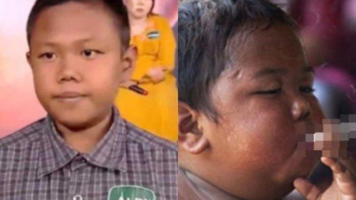Dulu saat Balita Merokok 40 Batang Sehari, Ardi Rizal Kini Berusia 16 ...
