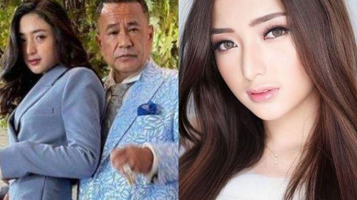 SOSOK Intan Nallendra, Aspri Hotman Paris Asal Jawa Timur, Dianiaya Waria karena Foto 'Gak Sopan ...